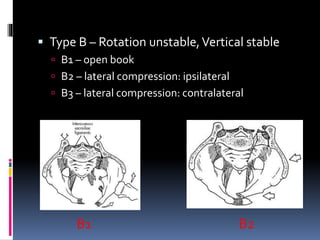 Pelvic injuries trauma 2012 | PPTX