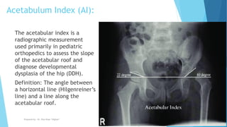 Presentation on Pelvic Lines. Dr Rais khan Afghan pdf | PDF