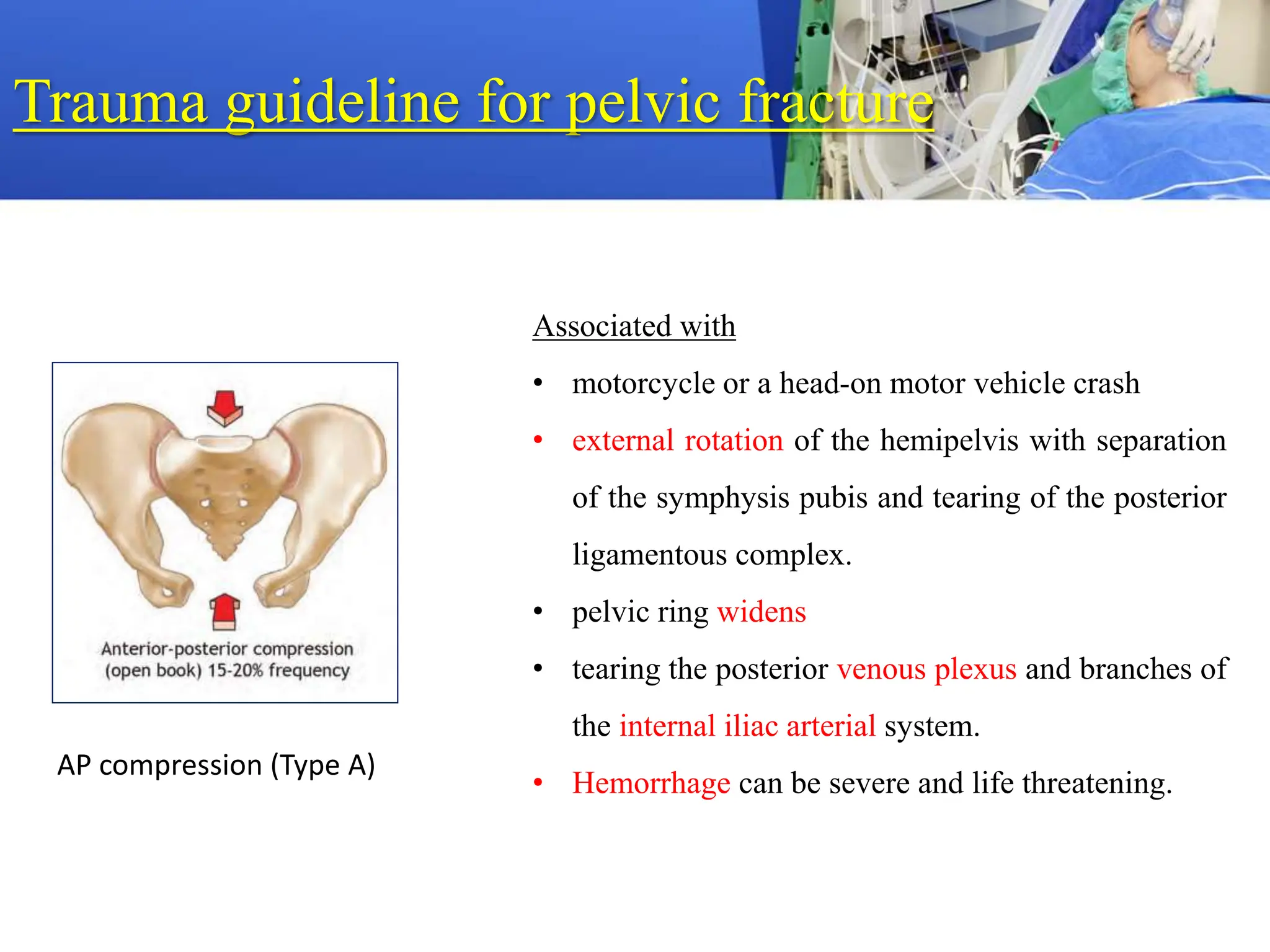 Pelvic fracture in anesthesia Literature Review.pptx