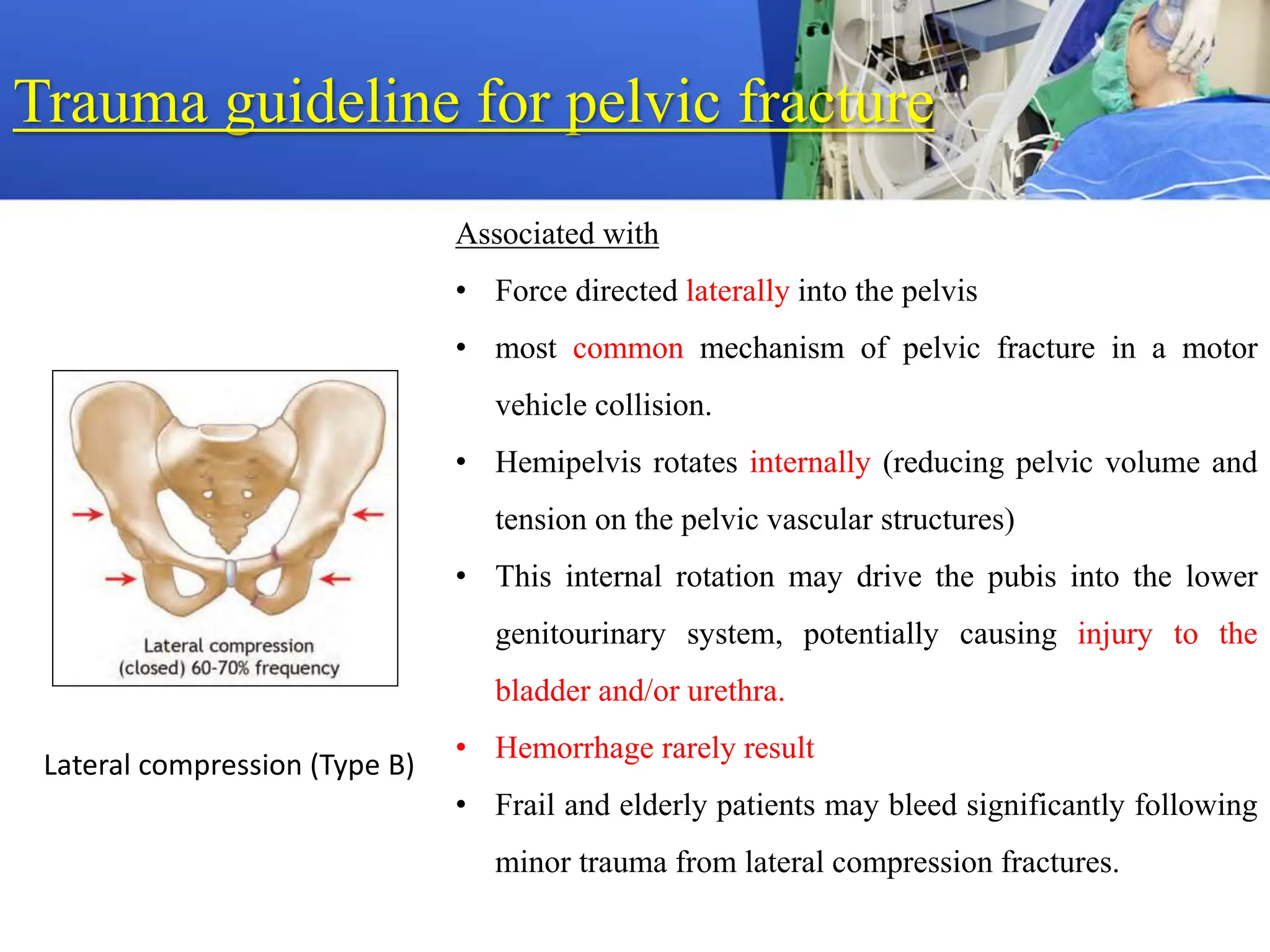 Pelvic fracture in anesthesia Literature Review.pptx