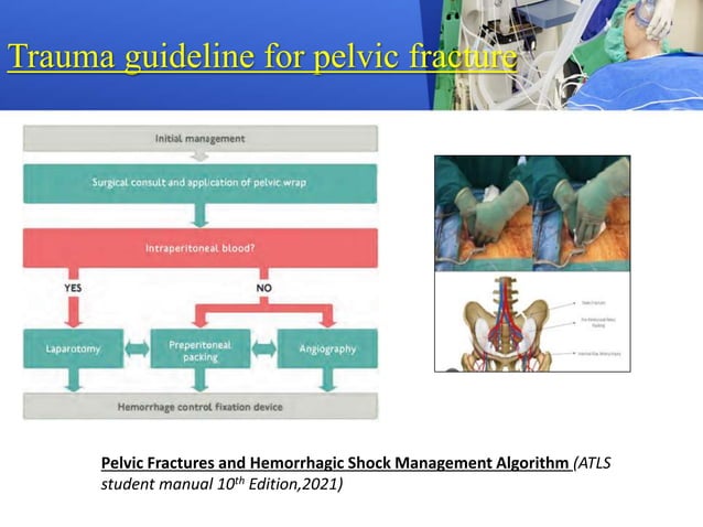 Pelvic fracture in anesthesia Literature Review.pptx
