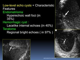 Sonographic Evaluation of Pelvic Masses | PDF