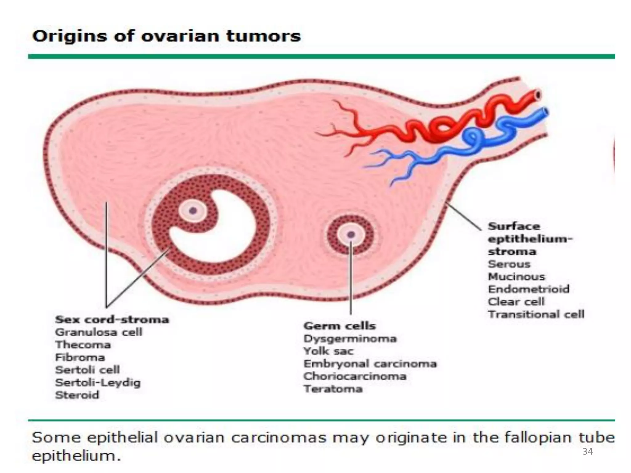 Pelvic mass Abde (2).pdf