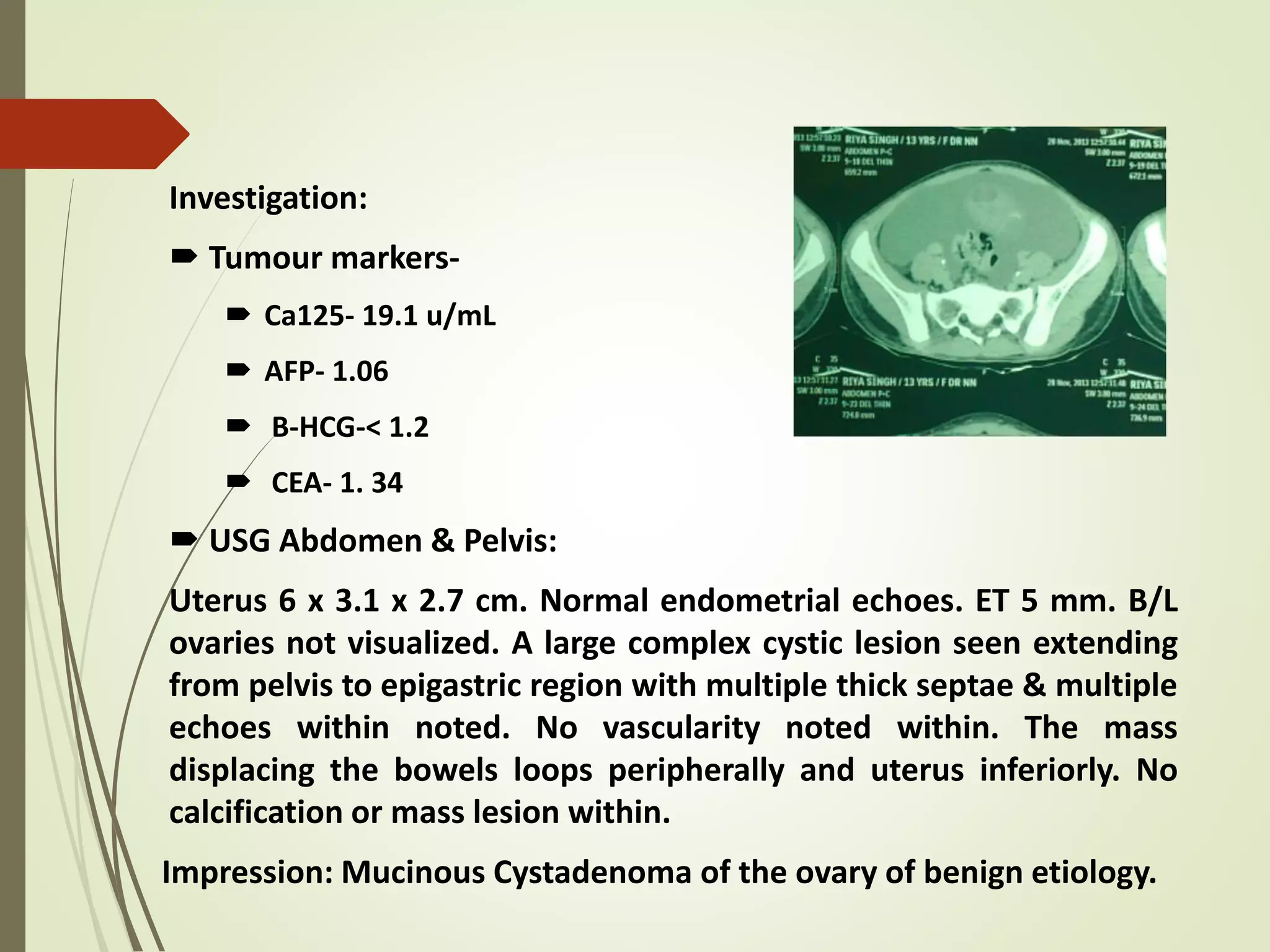 Pelvic mass panel discussion | PPTX