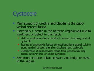 Pelvic organ prolapse | PPT