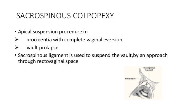 Pelvic organ prolapse gynaecology ppt