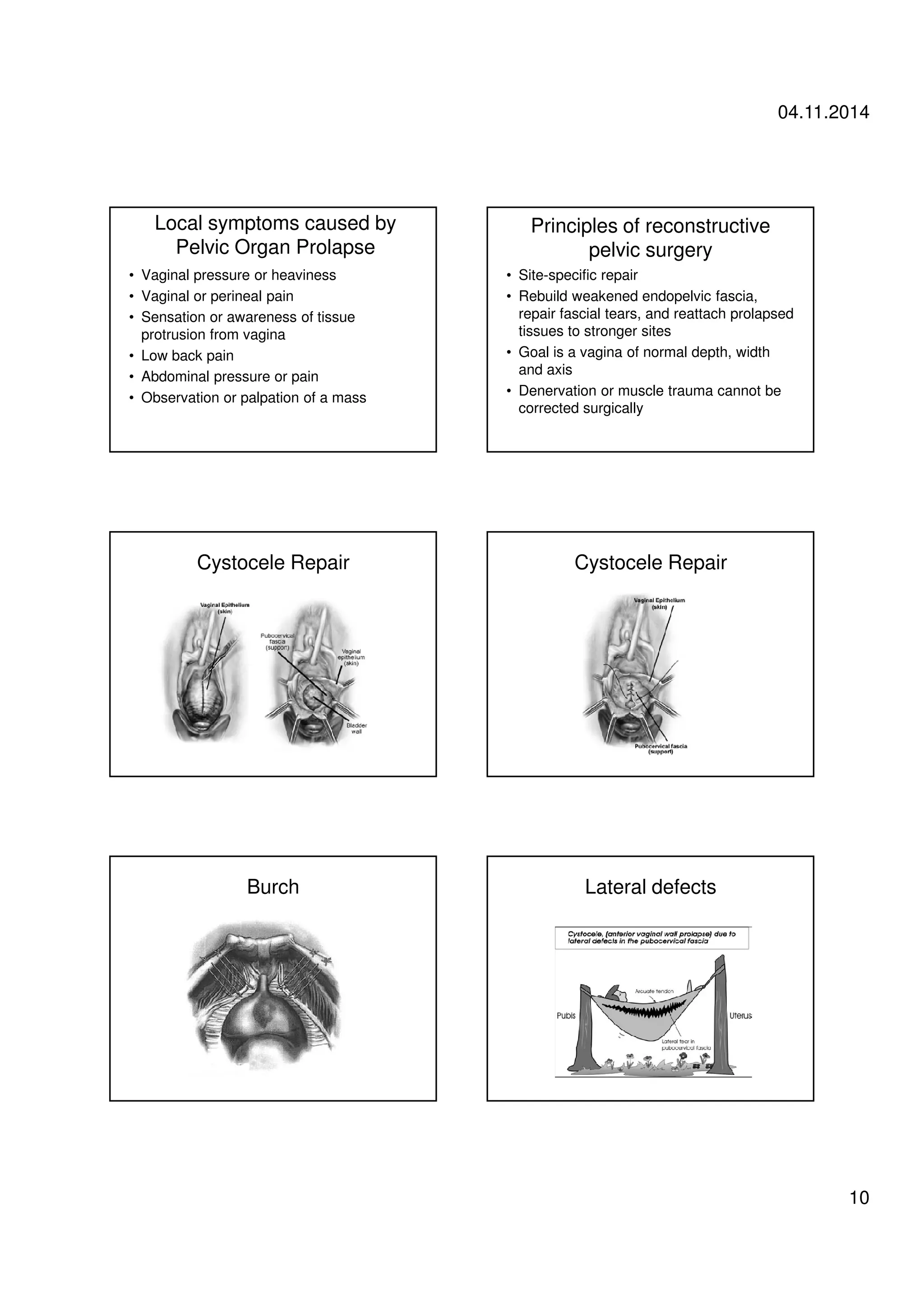 Pelvic organ prolapse - Diagnosis and treatment | PDF