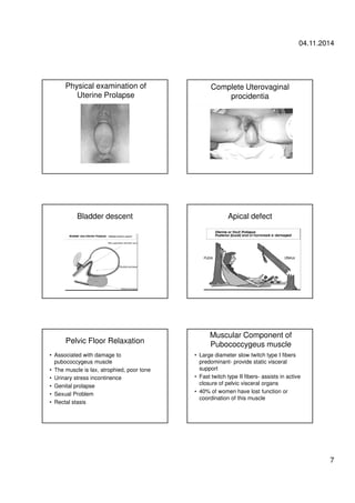Pelvic organ prolapse - Diagnosis and treatment | PDF