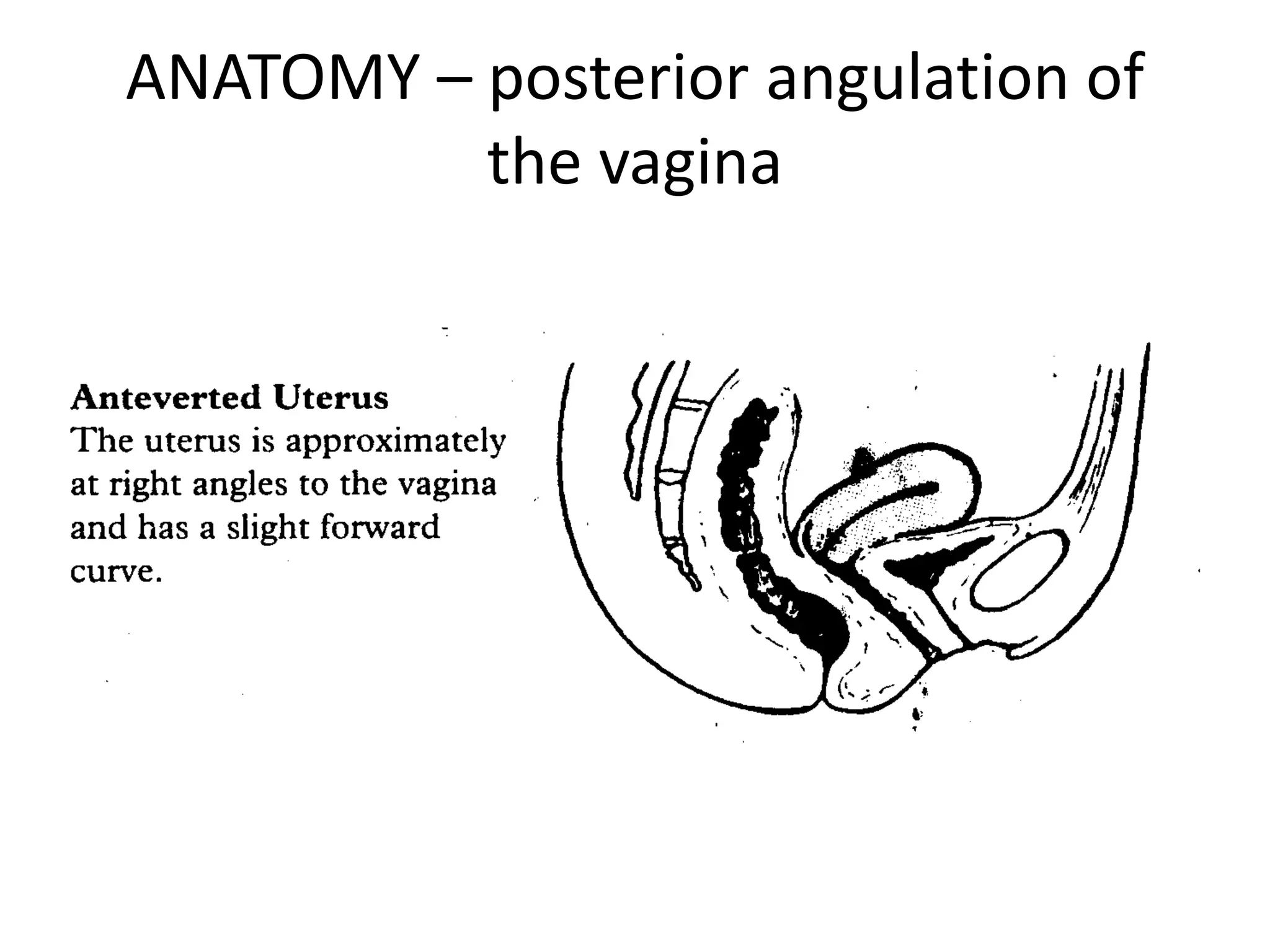 Pelvic Organ Prolapse Ppt