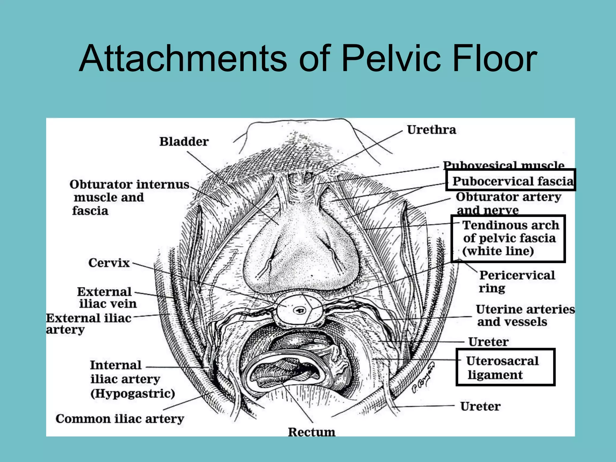 Pelvic organ prolapse | PPT