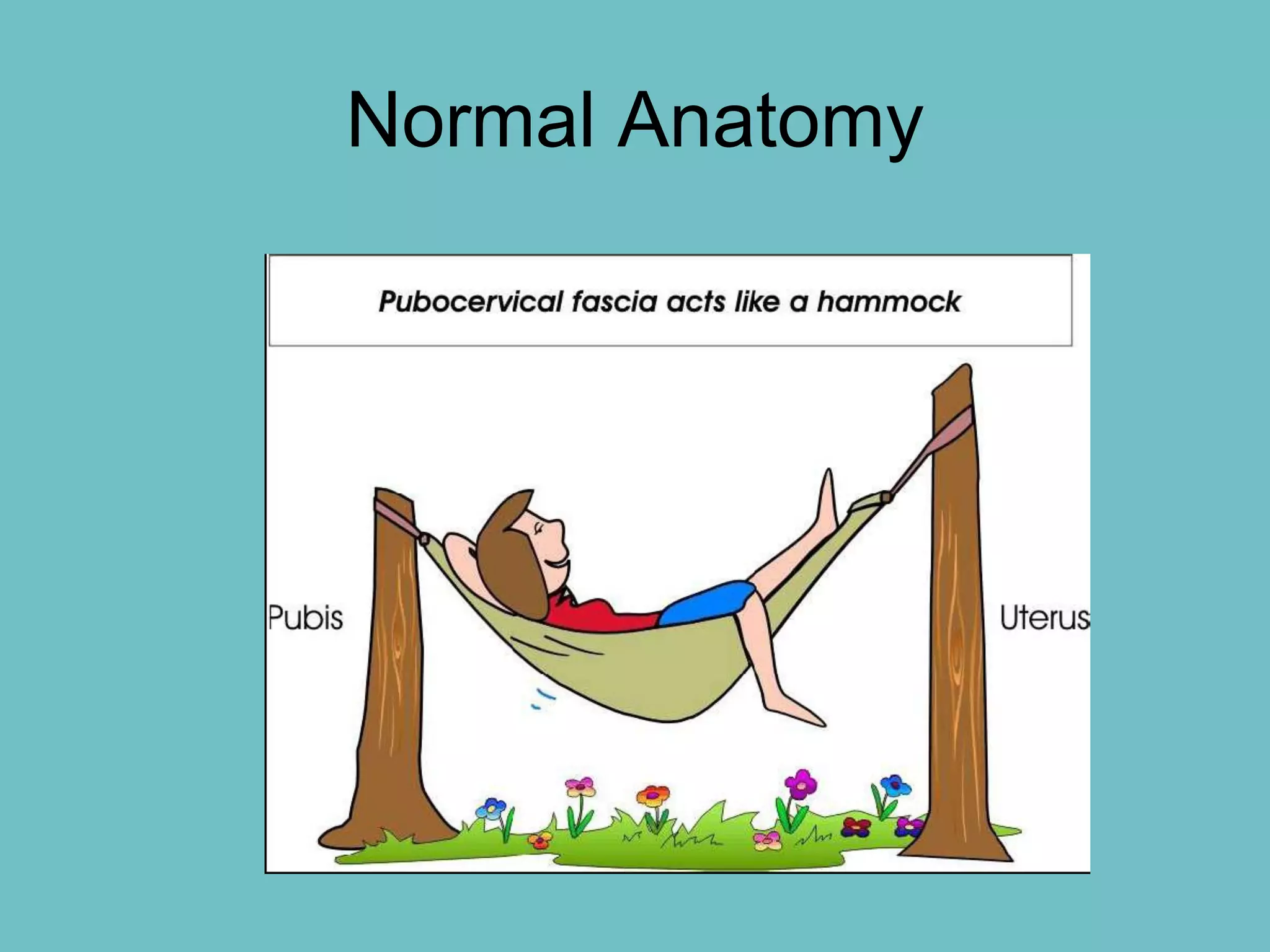Pelvic organ prolapse | PPT