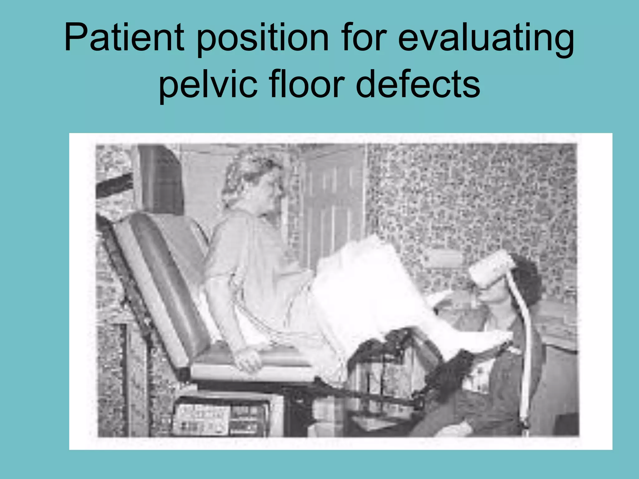 Pelvic organ prolapse | PPT