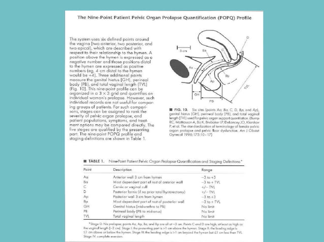 Pelvic organ prolapse | PPT