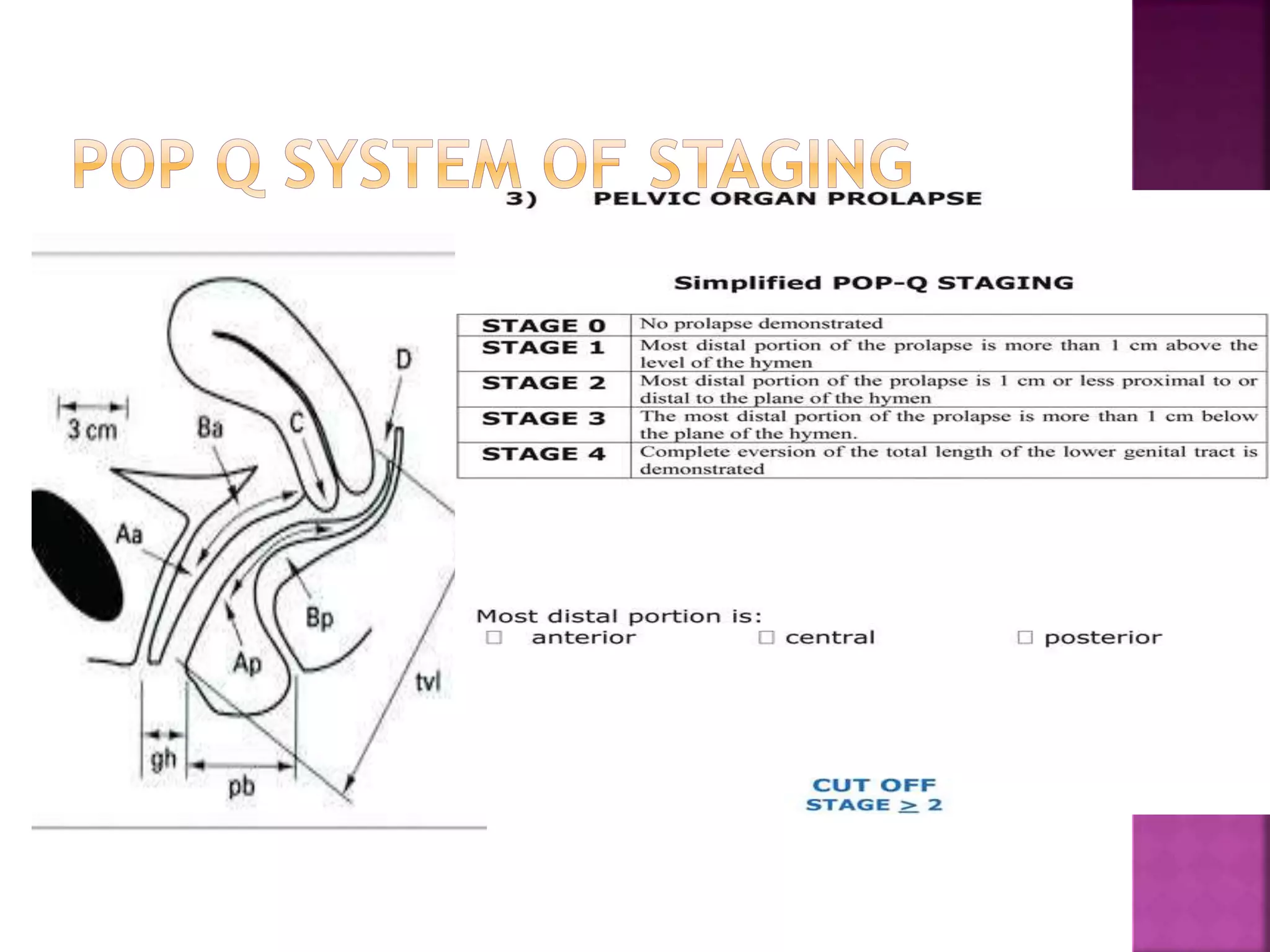 Pelvic organ prolapse | PPTX