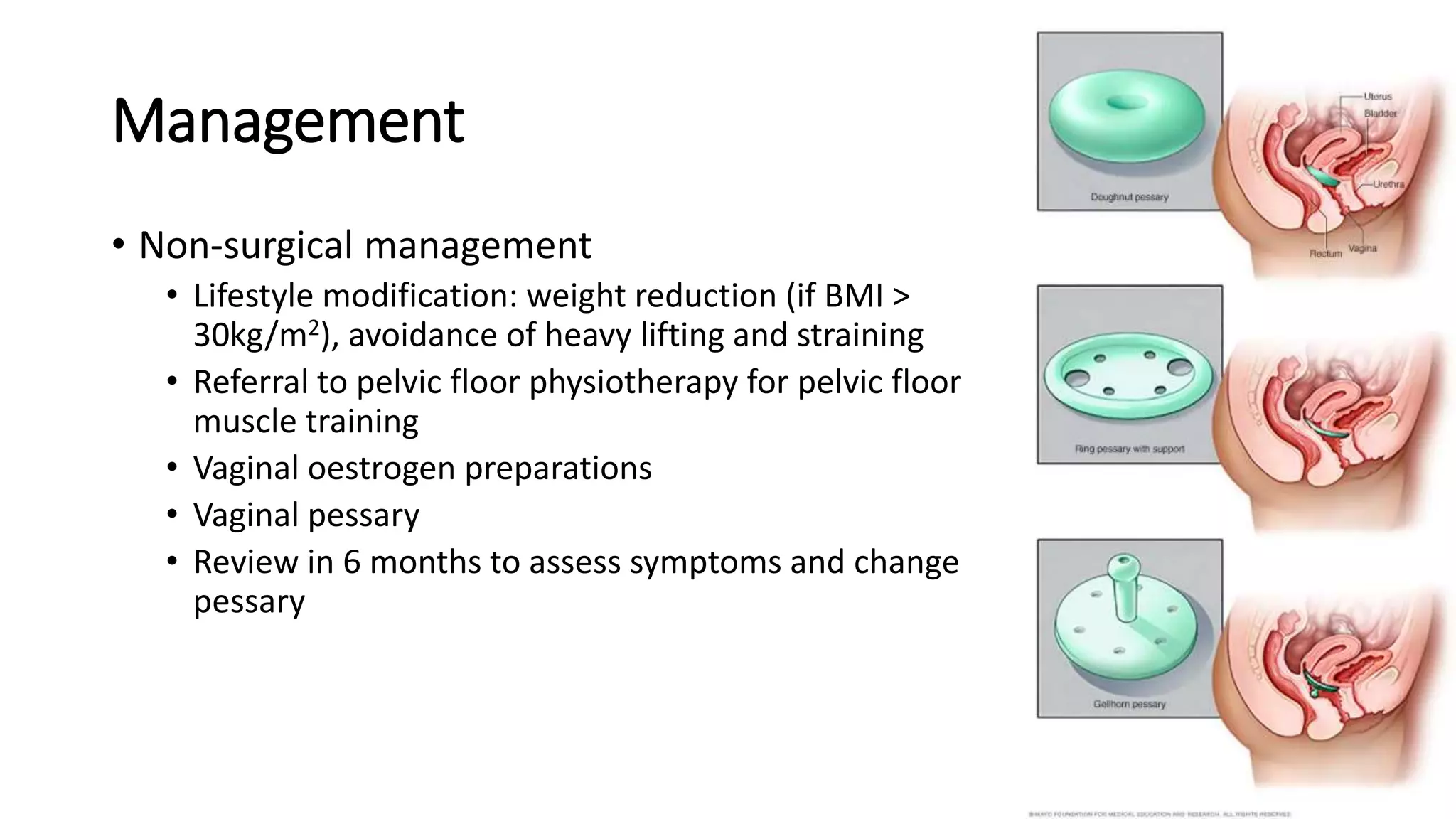 Pelvic Organ Prolapse.pptx