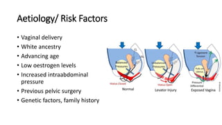 Pelvic Organ Prolapse.pptx