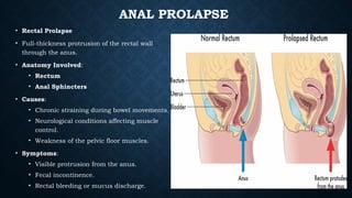Pelvic organ prolapse in womens health physiotherapy | PPTX