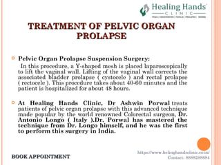 Pelvic Organ Prolapse Treatment | Surgeon in Bengaluru | Healing Hands ...