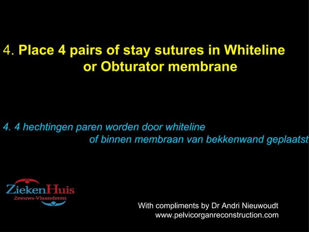 PelvicOrganReconstructive Surgery | PPT