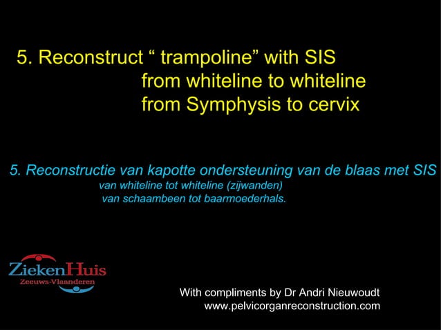 PelvicOrganReconstructive Surgery | PPT