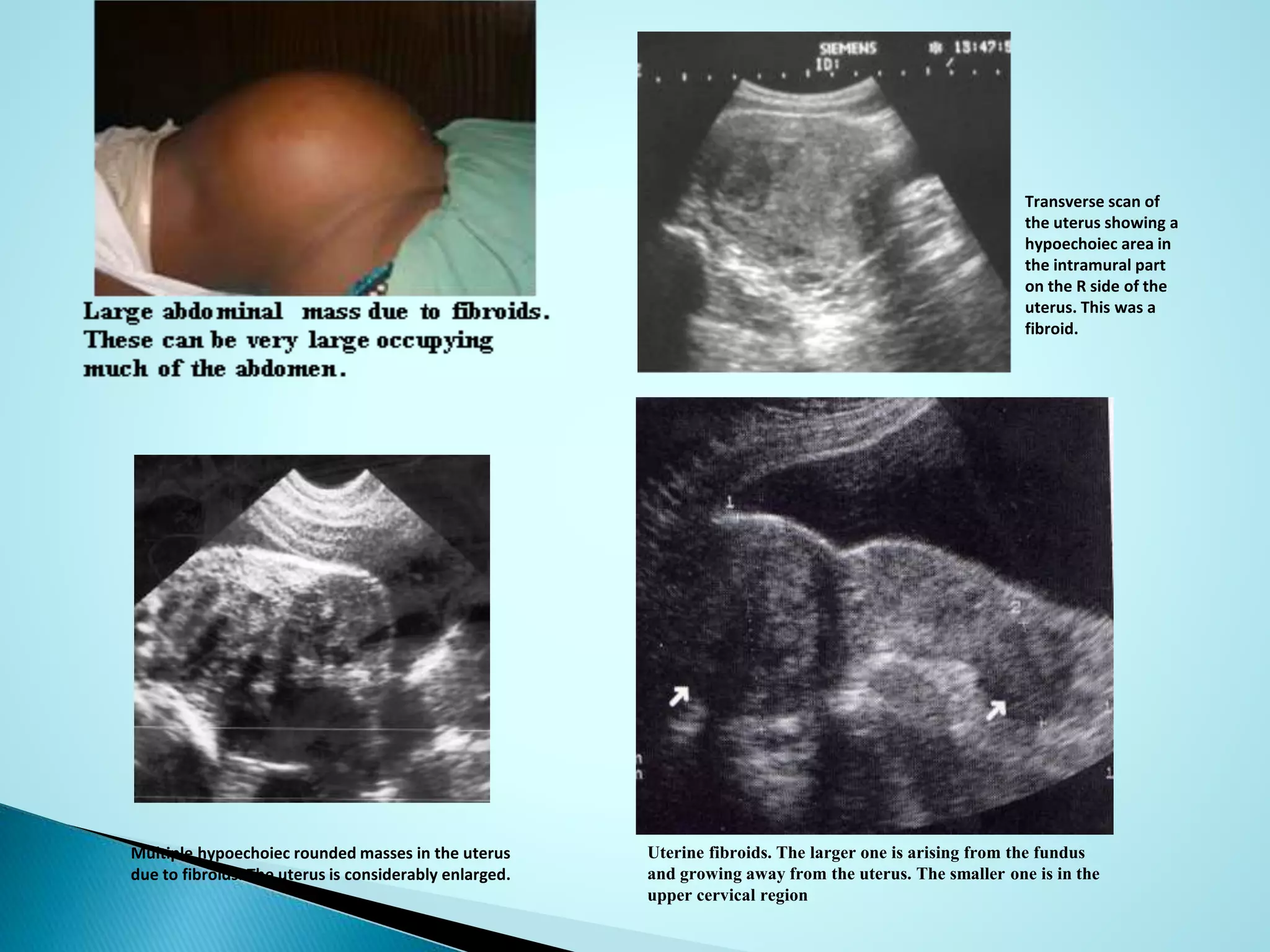 PELVIC PATHOLOGIES.pptx