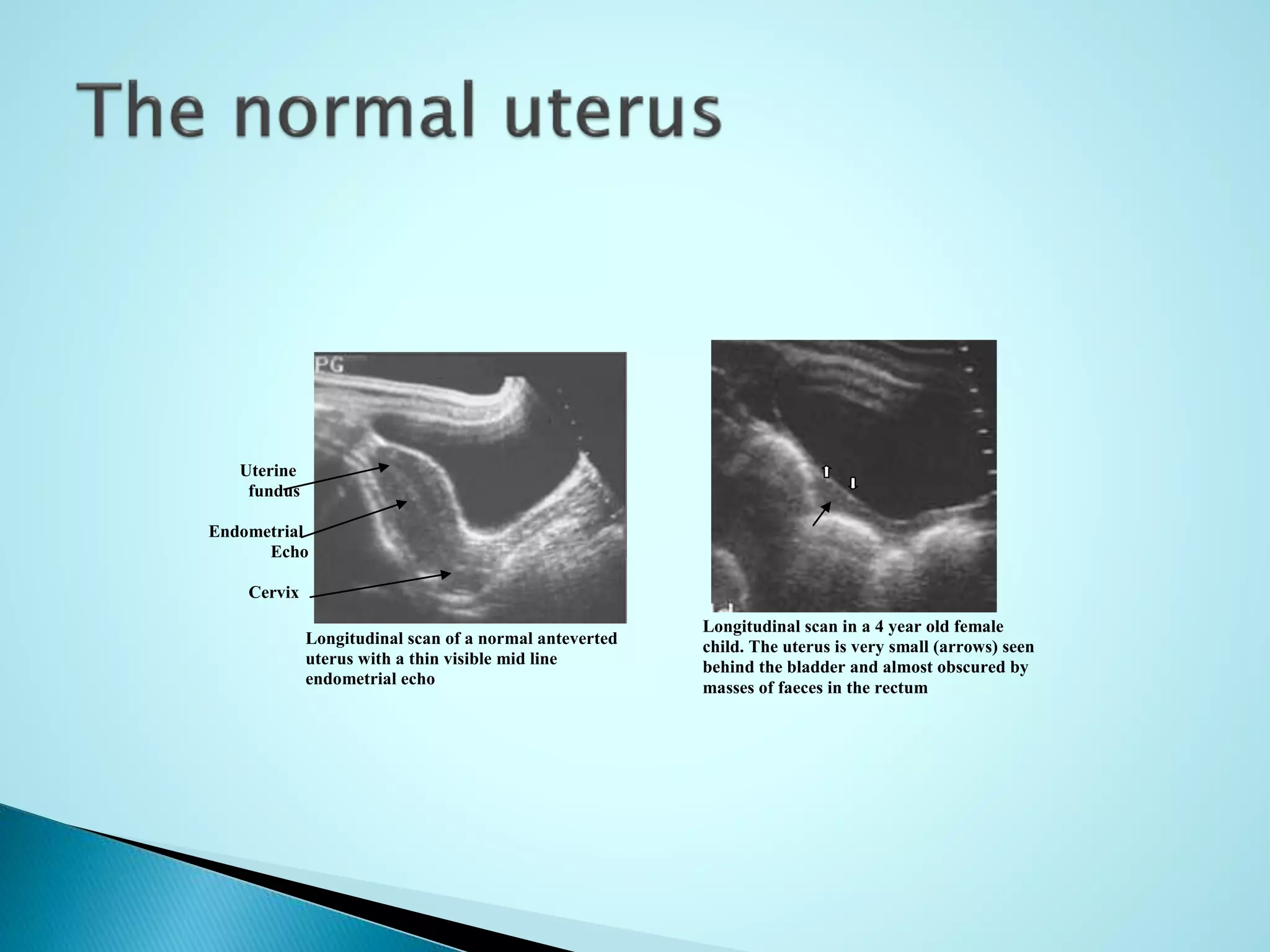 PELVIC PATHOLOGIES.pptx