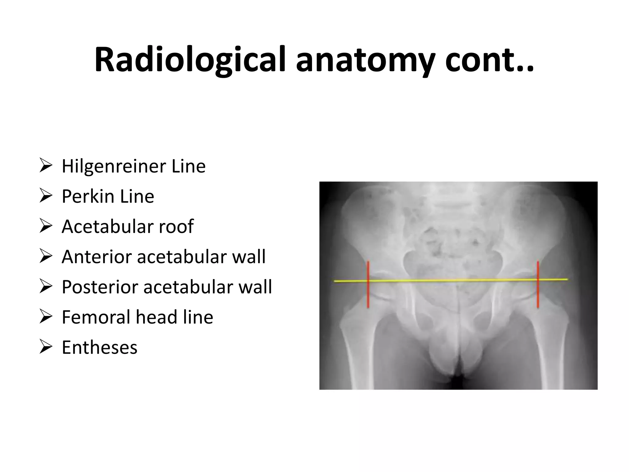Pelvic radiographs | PPTX