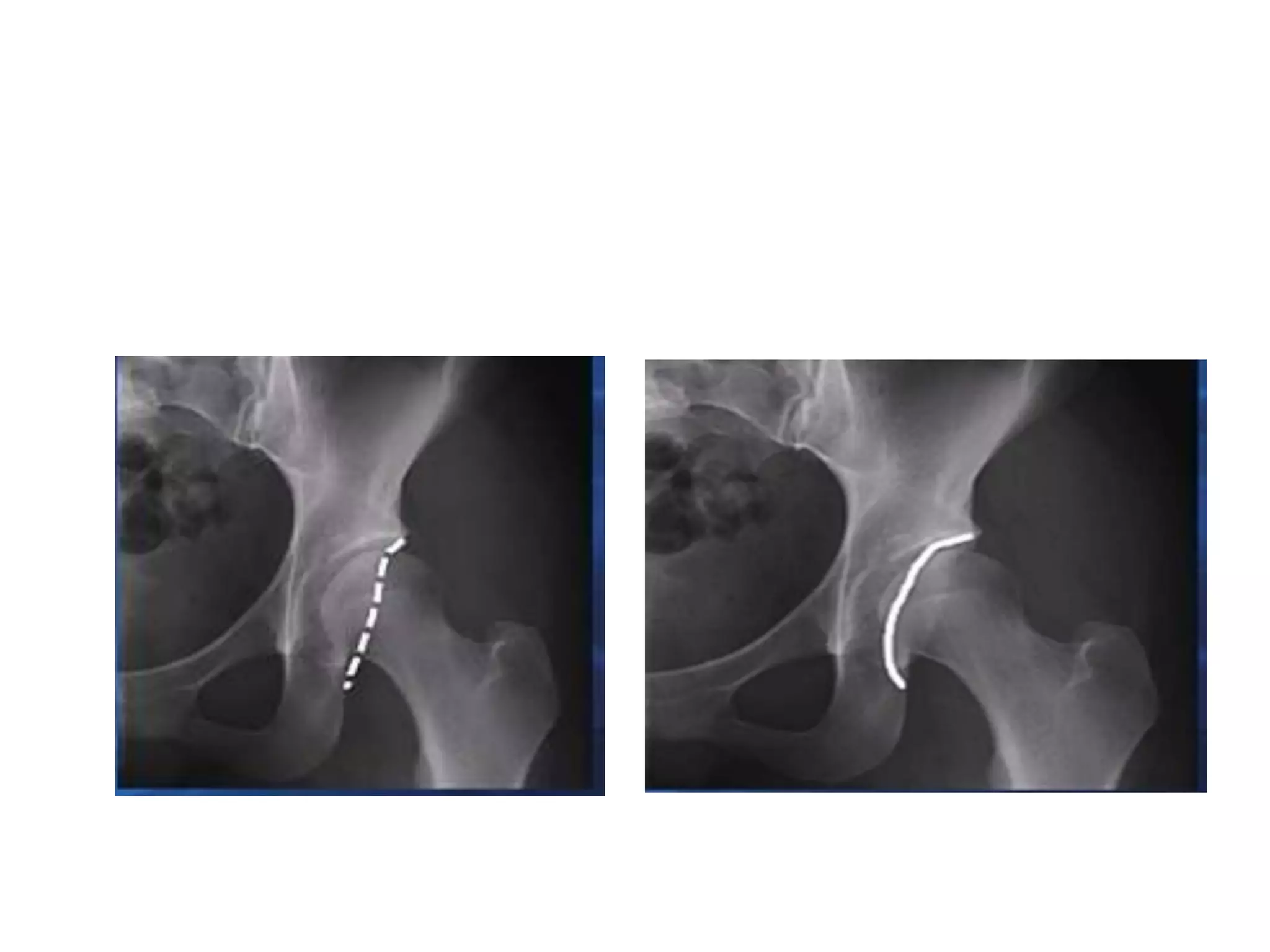 Pelvic radiographs | PPTX