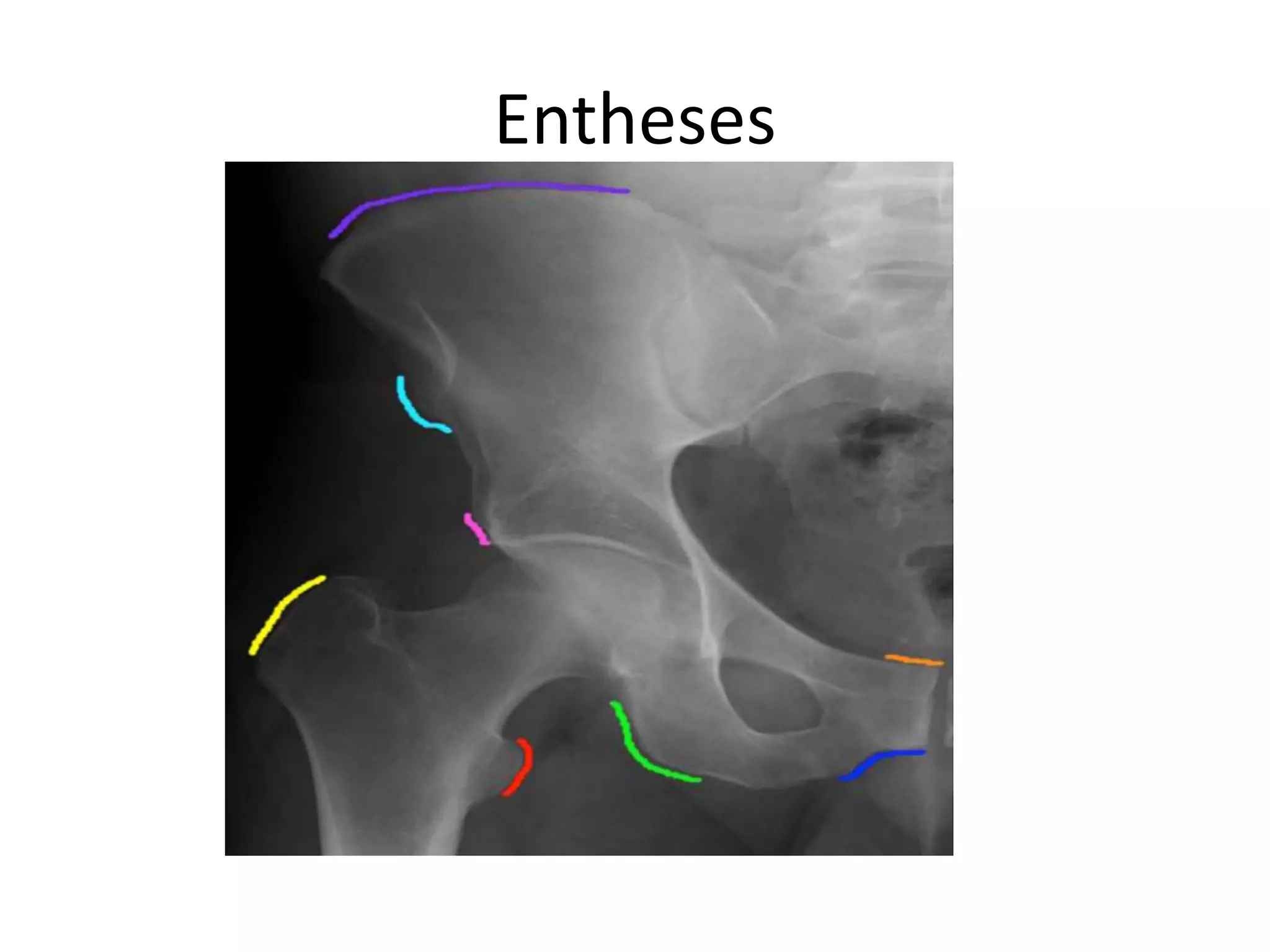 Pelvic radiographs | PPTX