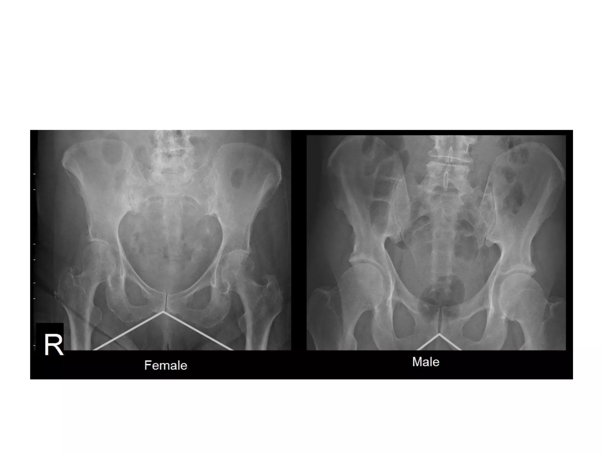 Pelvic radiographs | PPTX