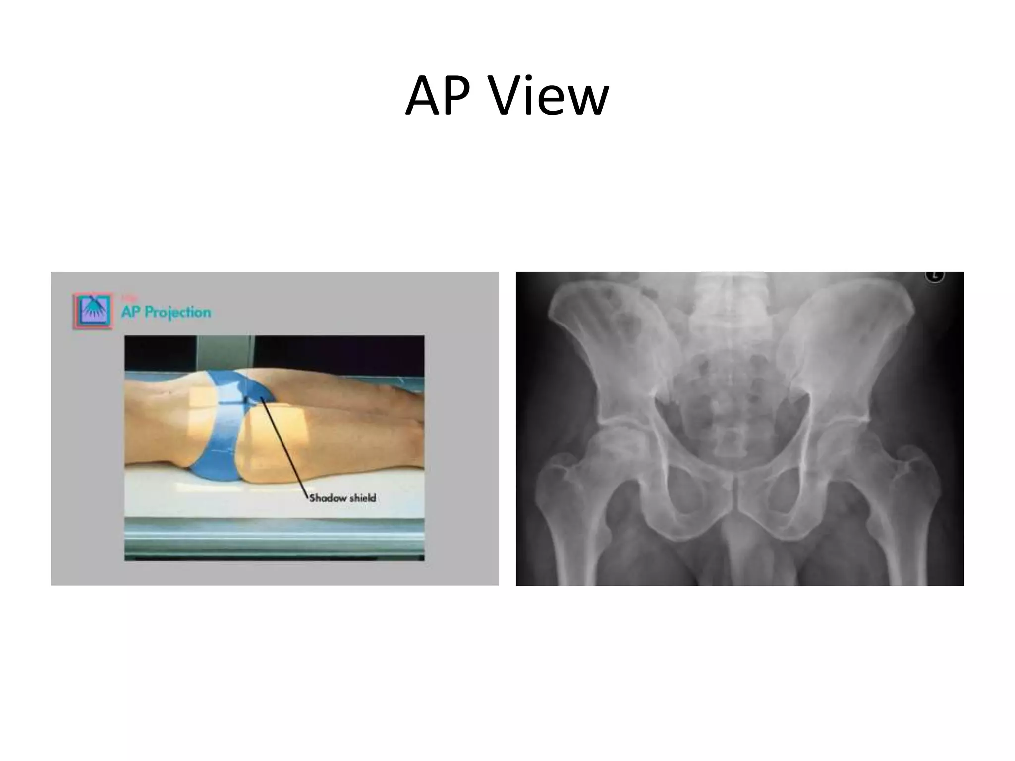 Pelvic radiographs | PPTX