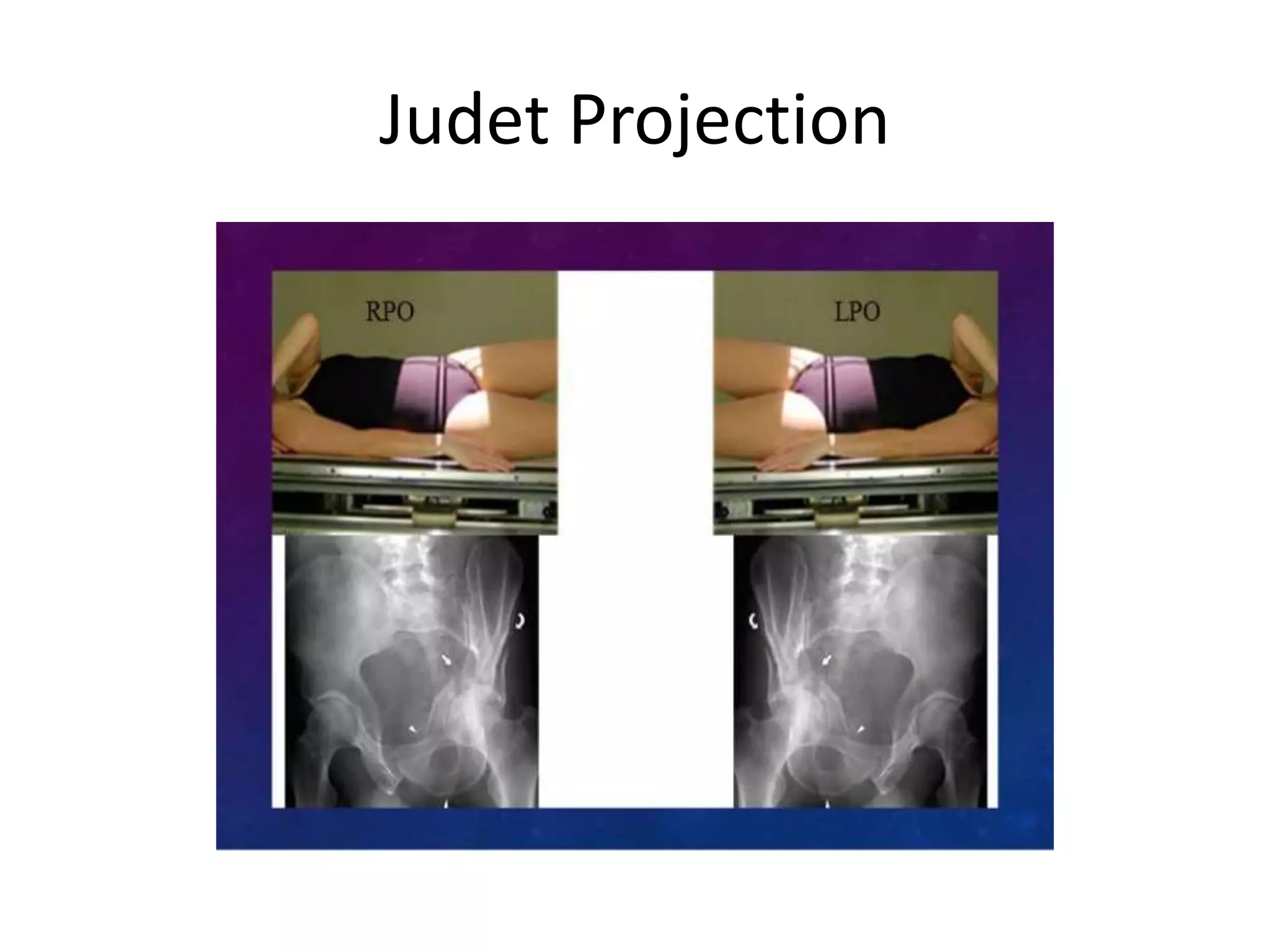 Pelvic radiographs | PPTX