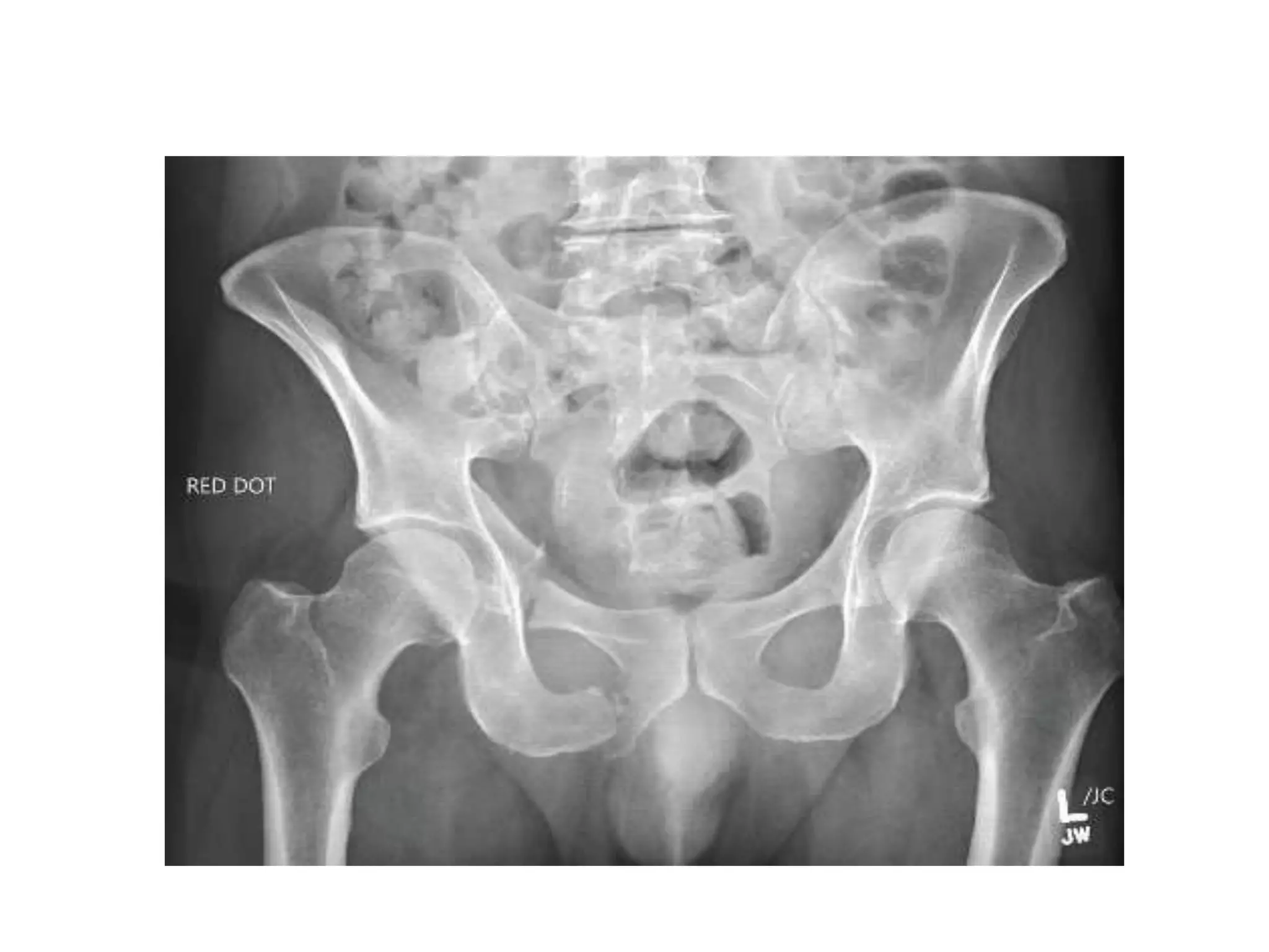 Pelvic radiographs | PPTX
