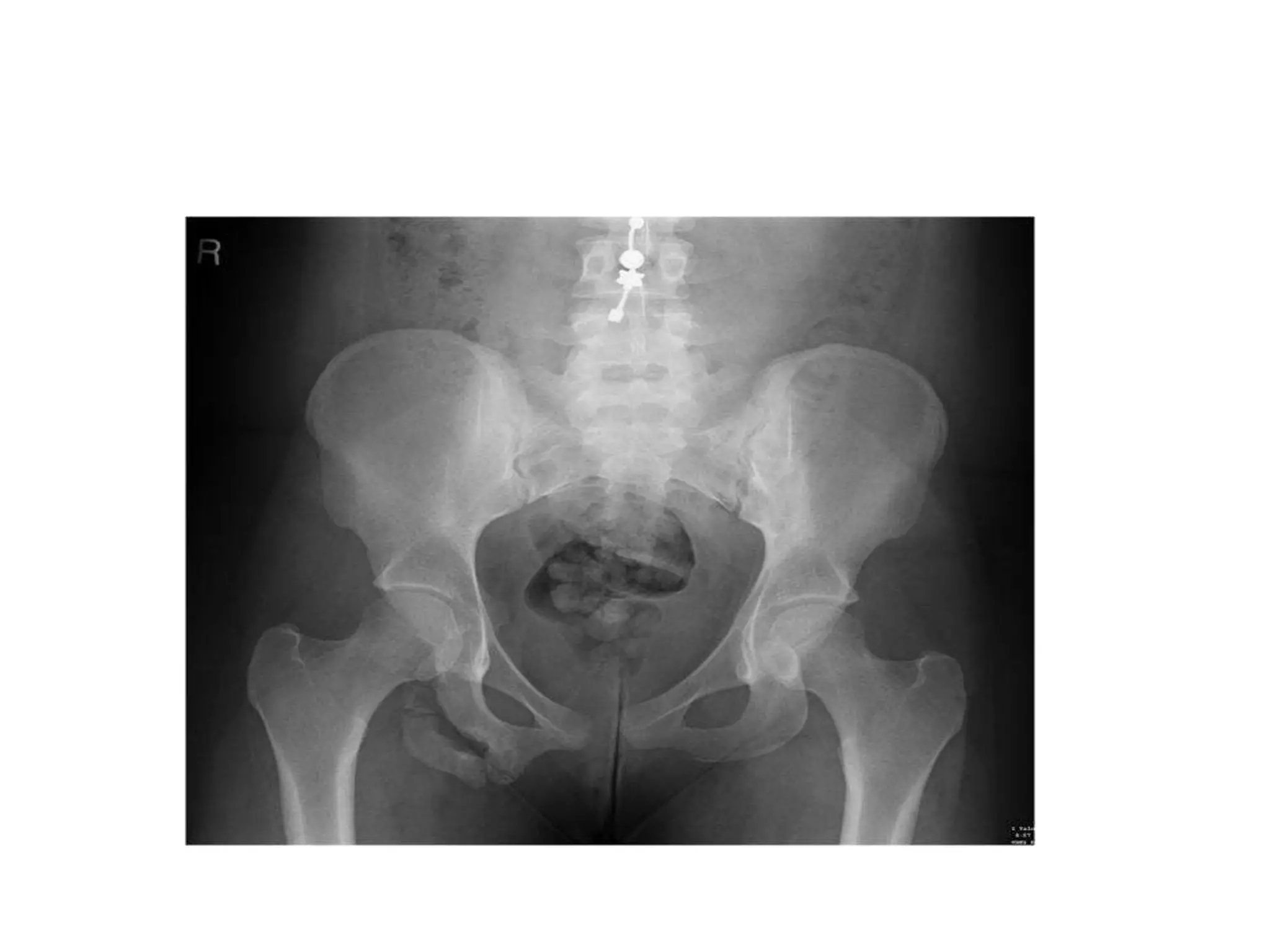 Pelvic radiographs | PPTX