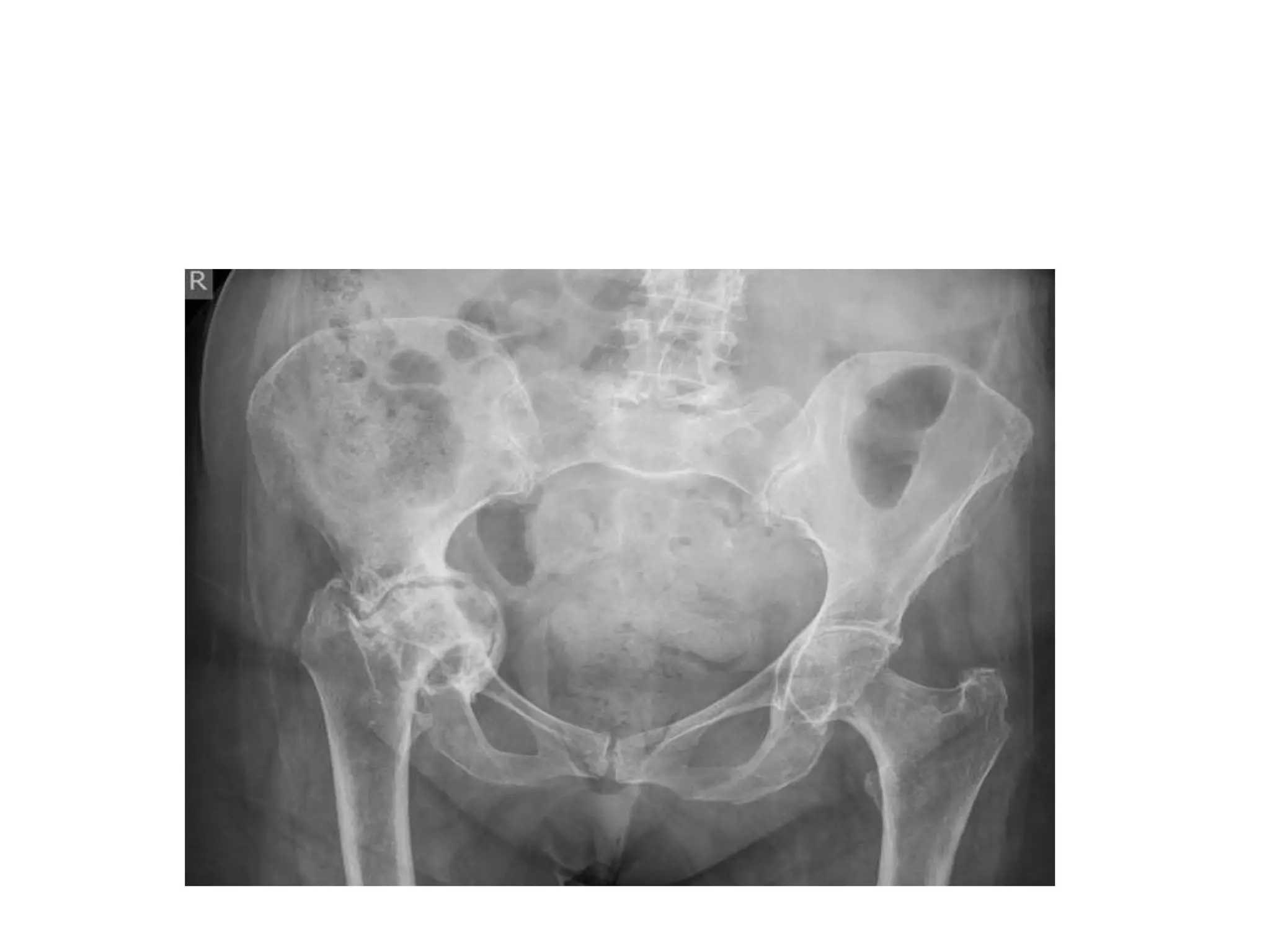 Pelvic radiographs | PPTX