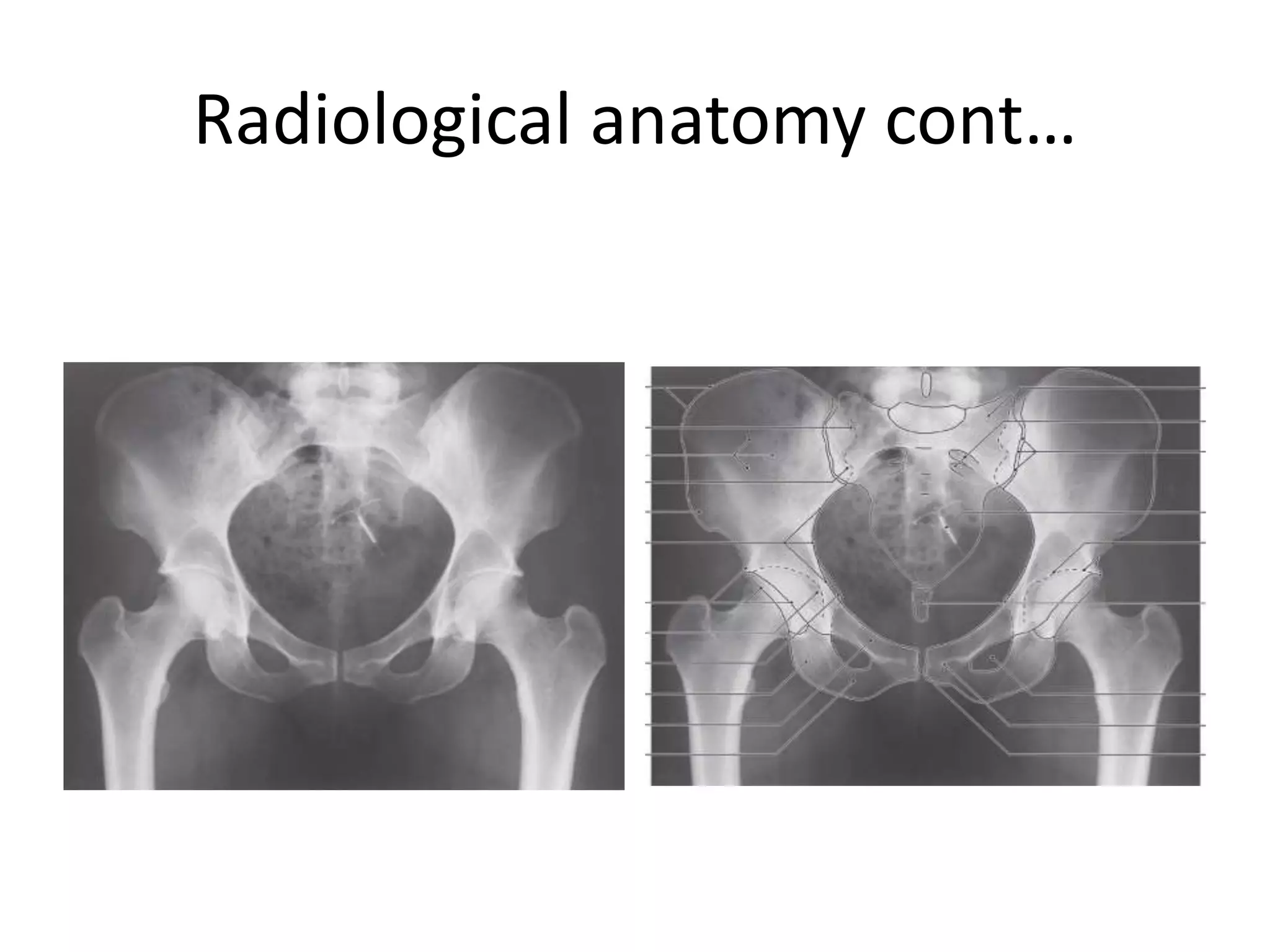 Pelvic radiographs | PPTX