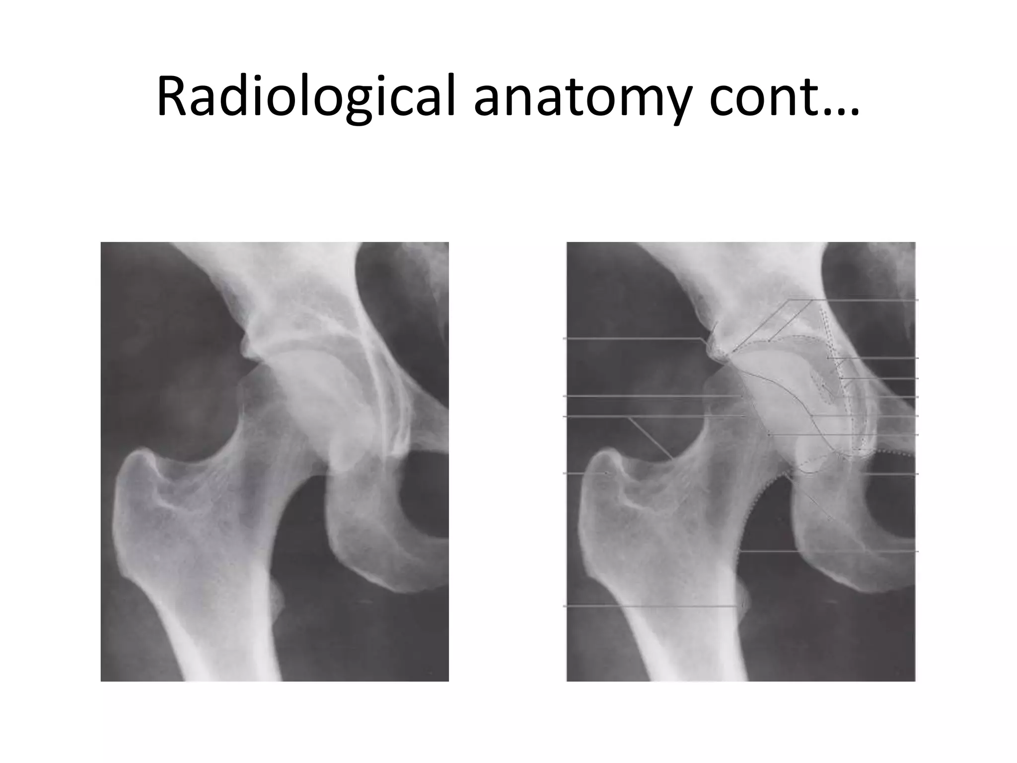 Pelvic radiographs | PPTX