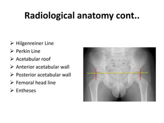 Pelvic radiographs | PPTX