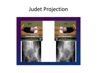 Pelvic radiographs | PPTX