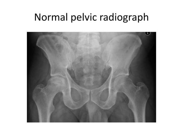 Pelvic radiographs | PPTX