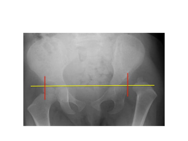 Pelvic radiographs | PPTX