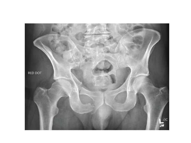 Pelvic radiographs | PPTX