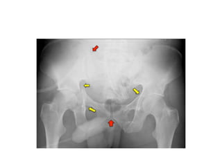 Pelvic radiographs | PPTX