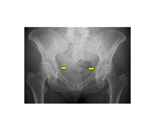 Pelvic radiographs | PPTX