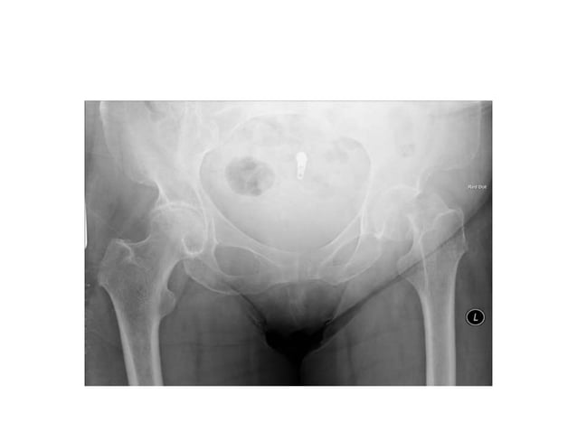 Pelvic radiographs | PPTX