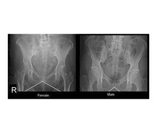 Young Female Pelvis X Ray Normal