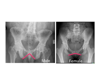 Male Vs Female Pelvis X Ray