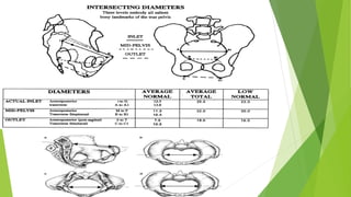 Pelvimetry | PPTX