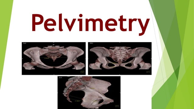 Pelvimetry | PPT