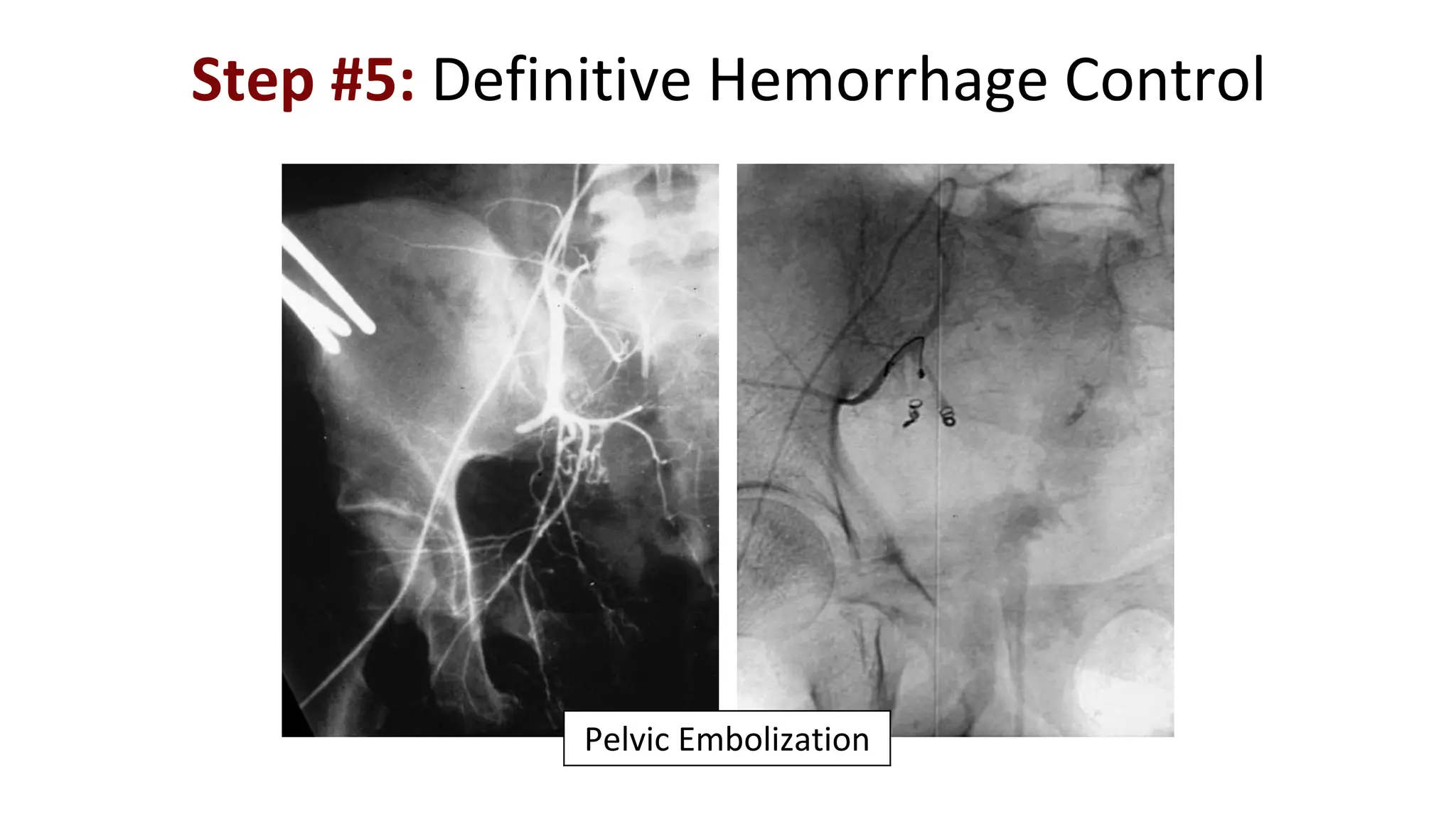 Adult Orthopedic Imaging Mastery Project - Pelvic Ring Fractures | PPTX